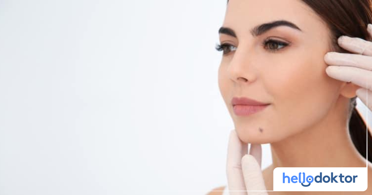 Barah Kulit Melanoma, Perhatikan Perubahan Tahi Lalat - Hello Doktor