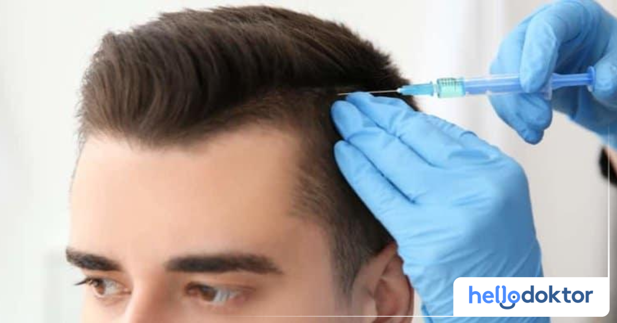 Tanam Rambut, Adakah Rawatan Ini Efektif Untuk Elak Masalah Botak?