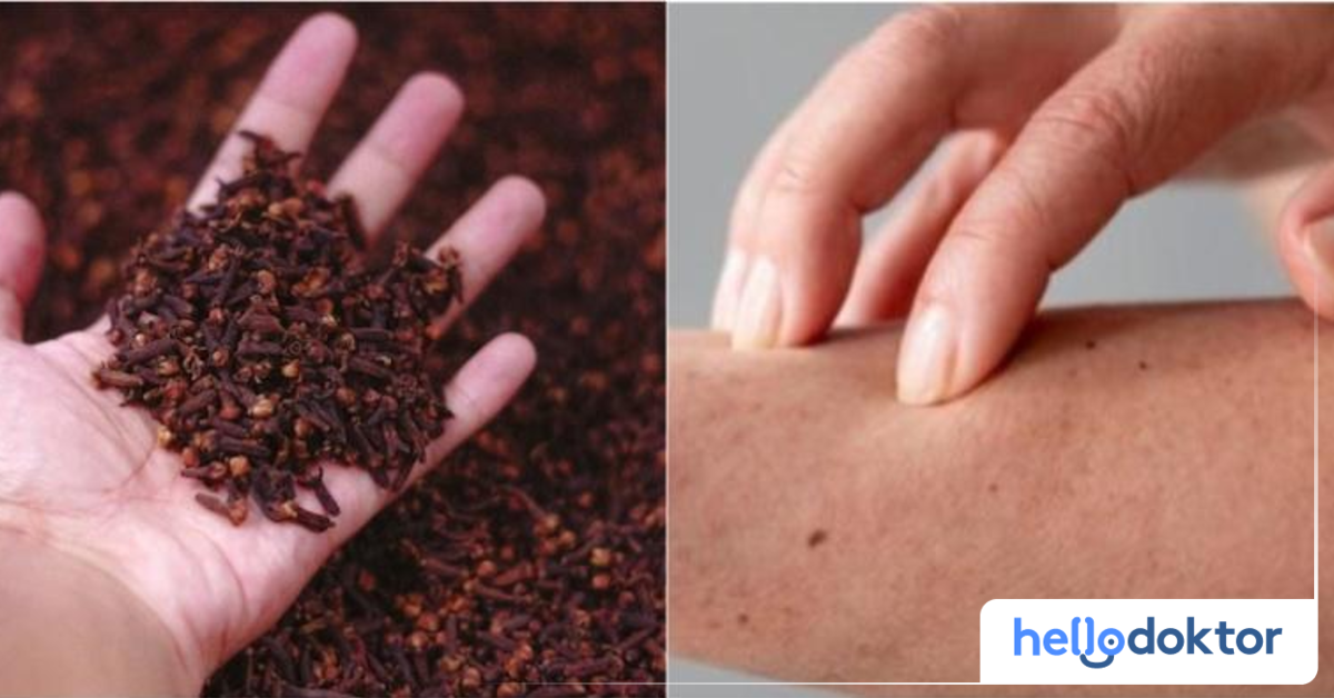 Keburukan Bunga Cengkih: Ini 7 Bahaya Bunga Cengkih Jika Salah Guna