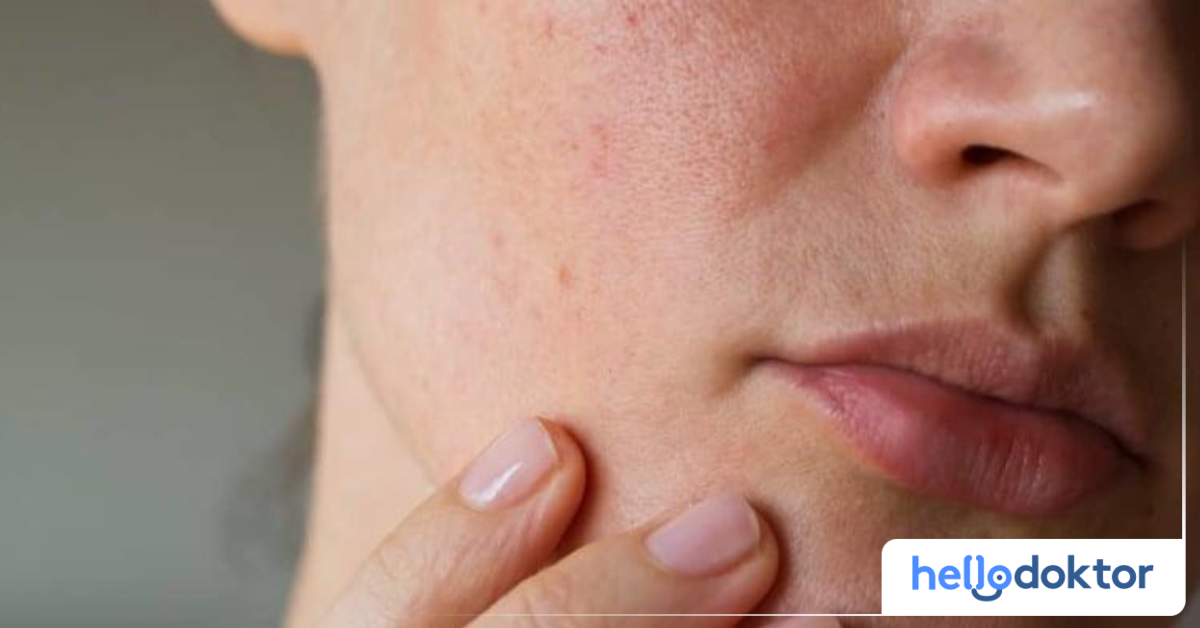 Fungsi Kulit & Struktur Kulit, Apa Yang Individu Perlu Tahu Tentangnya?